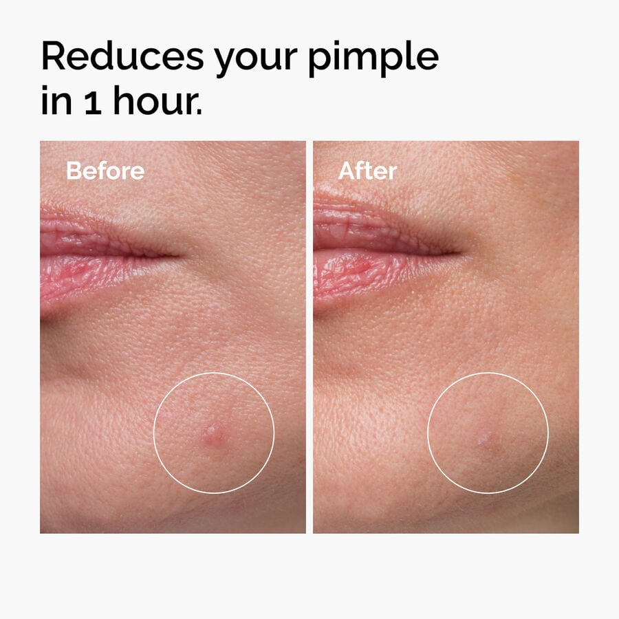 sulfur tablets side effects