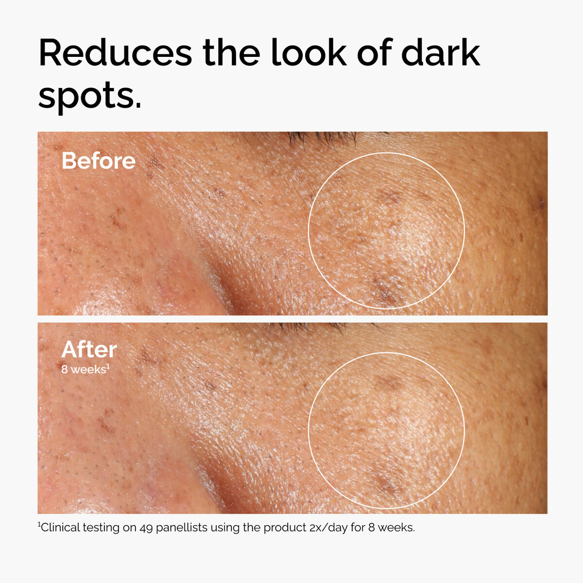 Alpha Arbutin 2% + HA Aufhellendes Serum für eine ungleichmäßige Haut