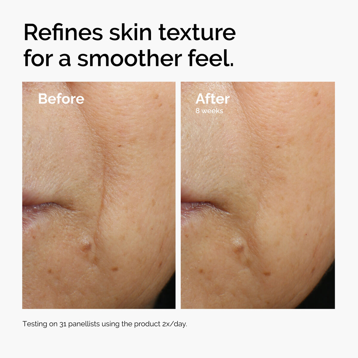 Caffeine 3% + Escin 1% Face Serum: Firm & Define | The Ordinary