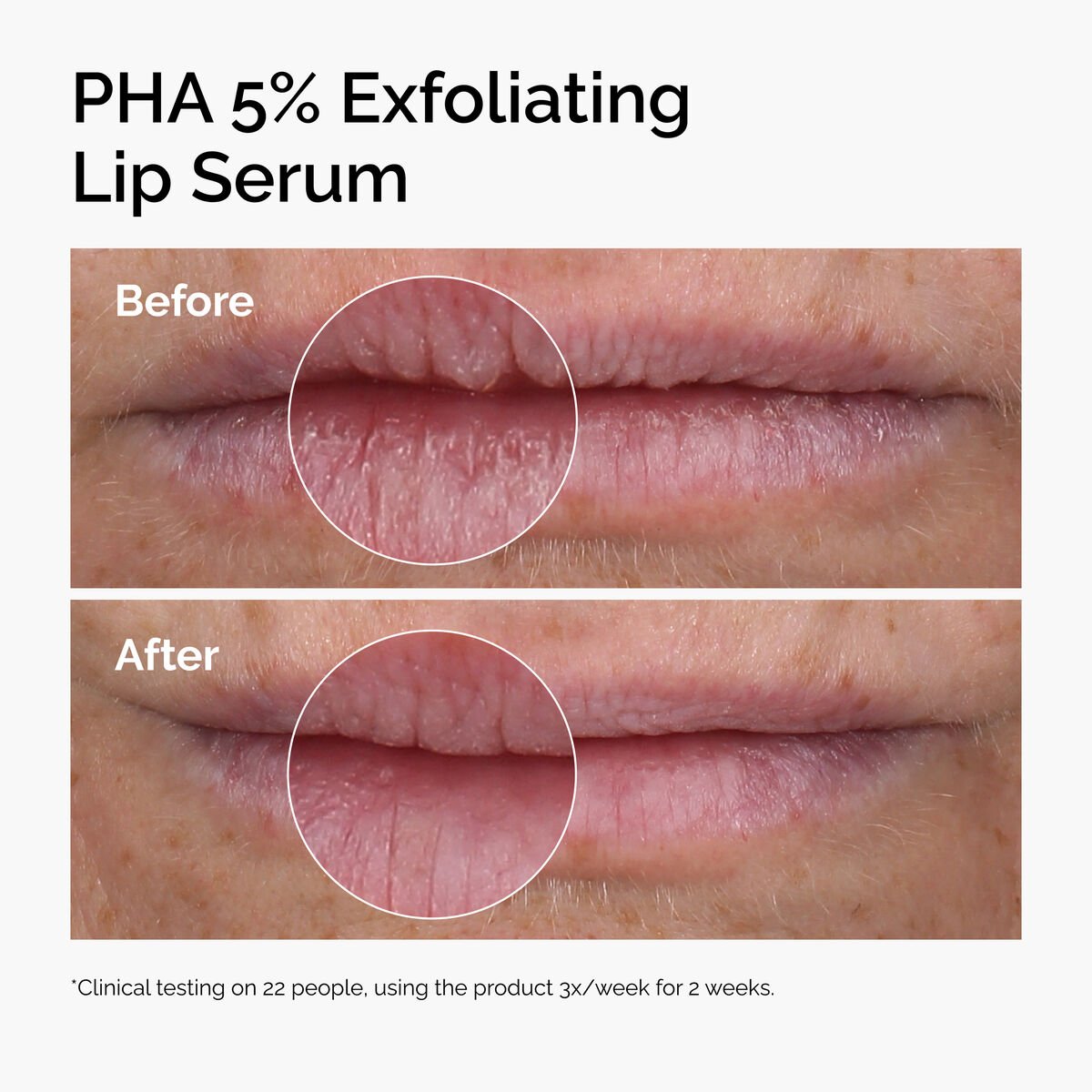PHA 5% Exfoliating Lip Serum | The Ordinary