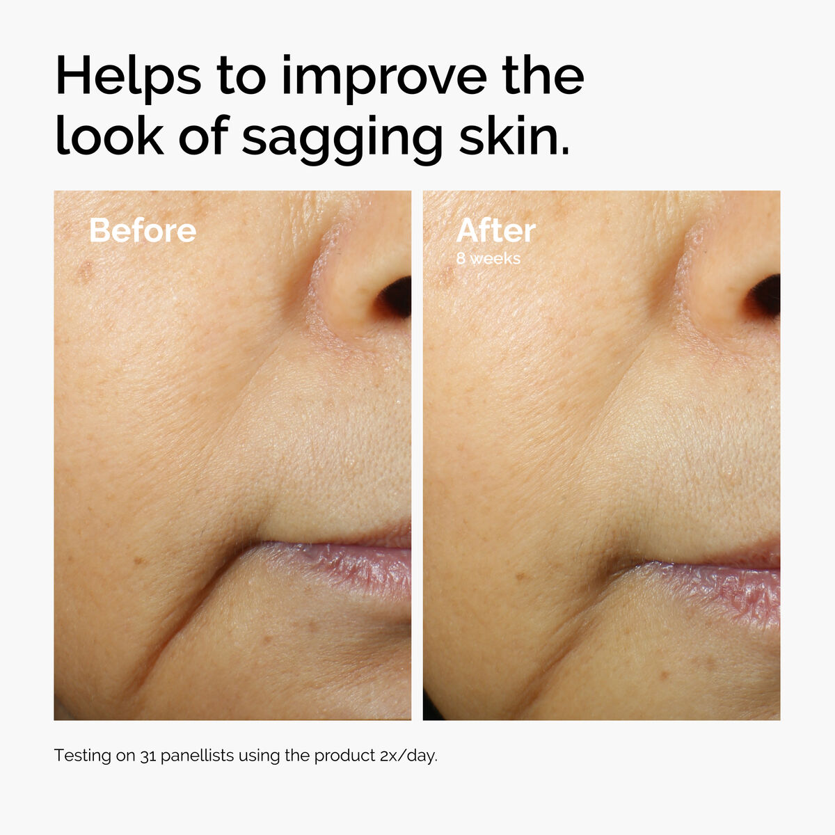 Caffeine 3% + Escin 1% Face Serum: Firm & Define | The Ordinary