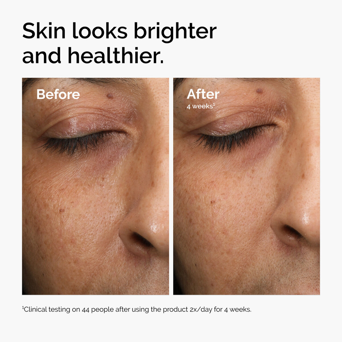 Multi-Antioxidant Radiance Serum | The Ordinary