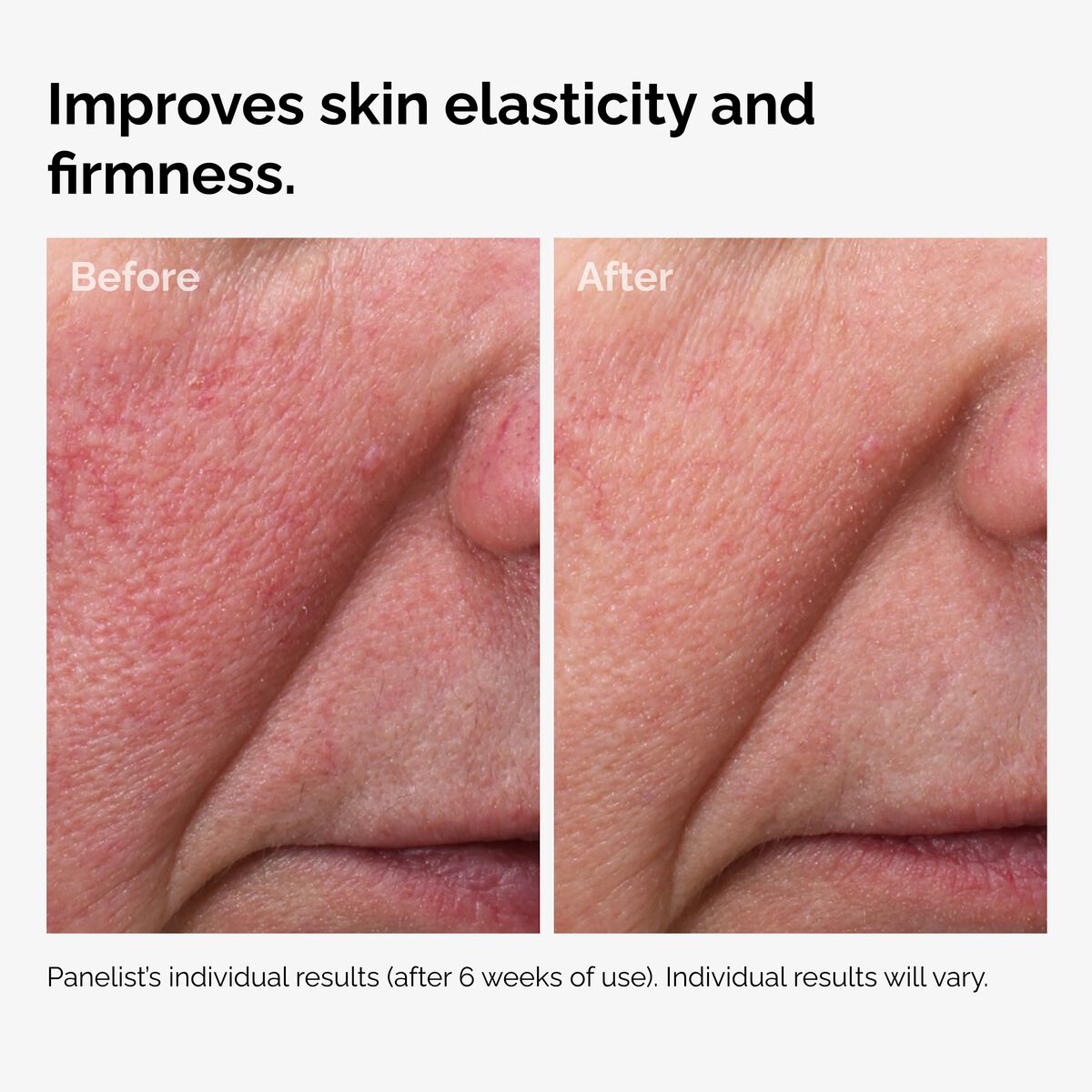 100% Fermented Rose Hip Seed Oil | The Ordinary